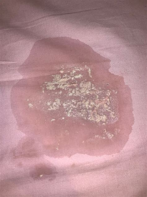 WEIRD DISCHARGE DURING SEX Glow Community