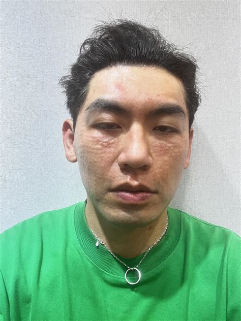 我最後還是鼓起勇氣去了⋯⋯