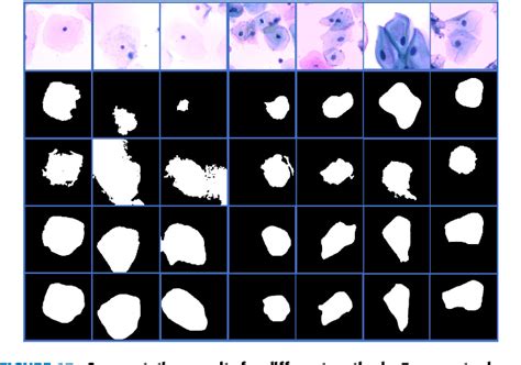figure 1 from segmentation of cervical cell images based on generative