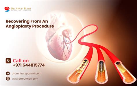 Carotid Angioplasty With Stent Details Dr Arun Hari