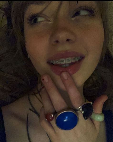 Pin By öznur On Ive Got My Eye On You Cute Braces Braces Girls Brace Face