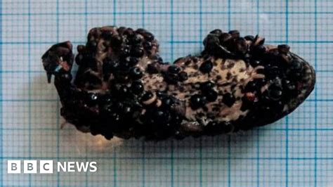 Manchester Nandos Salad Contained Decomposed Frog Bbc News