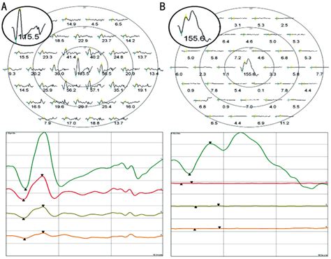 Plot And Trace Arrays Of Each Recording Protocol A Protocol 1 B