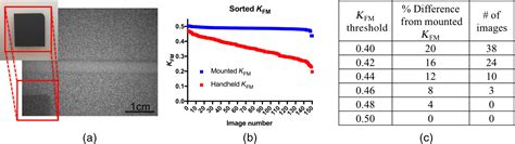 Correcting For Motion Artifact In Handheld Laser Speckle Images