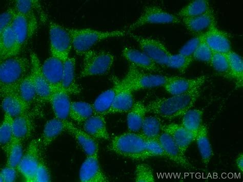 Adropin Antibody 25213 1 AP Proteintech