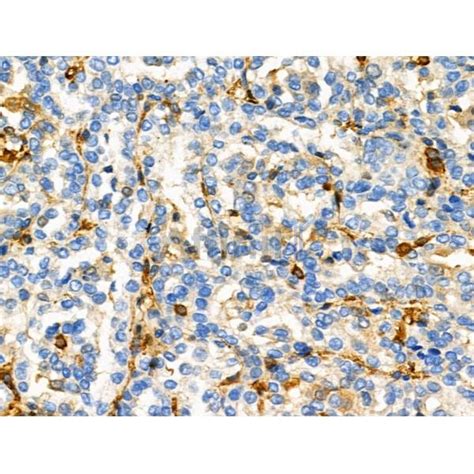 Ferritin Heavy Chain Antibody Affinity Biosciences Ltd亲科生物官网