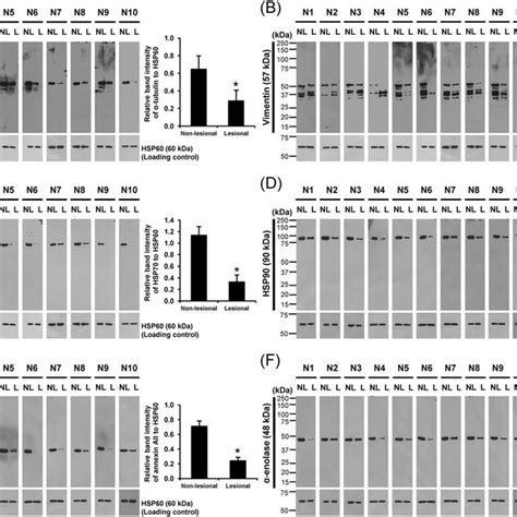 Validation Of The Proteomic Data And Quantitative Analysis By Western