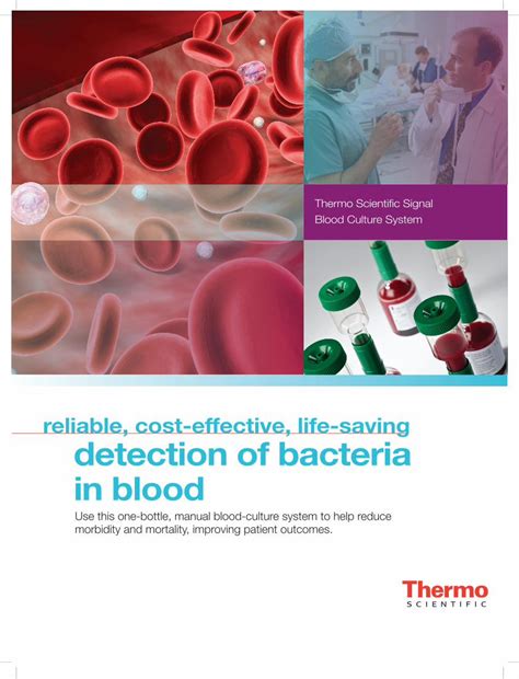 Pdf Reliable Cost Effective Life Saving Detection Of Ams Ro