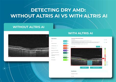 Dry Macular Degeneration Treatment Breakthroughs