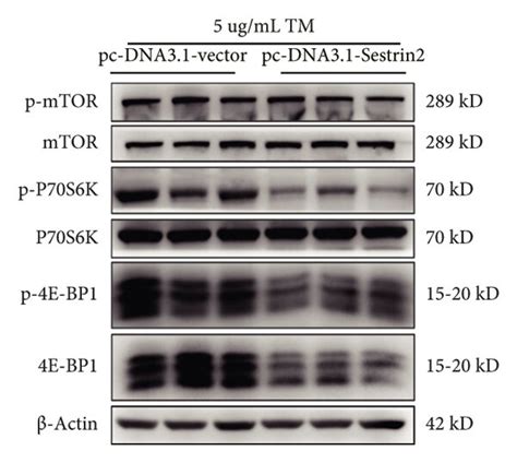 Sestrin2 Overexpression Inhibits Tm Induced Mtor Pathway Activation