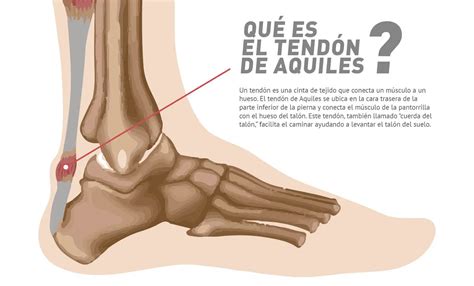 Tendón de Aquiles Parte Las lesiones de Aquiles Por qué se producen y son tan difíciles de