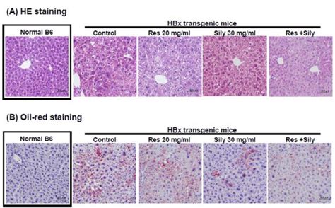 Beneficial Effects Of Resveratrol Combined With Silymarin On Liver