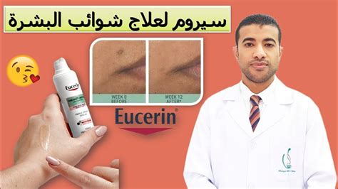 سيروم يوسرين الأفضل لعلاج بقع حب الشباب والمسام الواسعة Eucerin