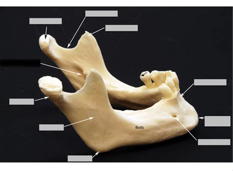Mandible Diagram Quizlet