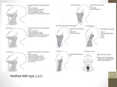 Management Of Oral Cavity Cancer 23072018 Pptx