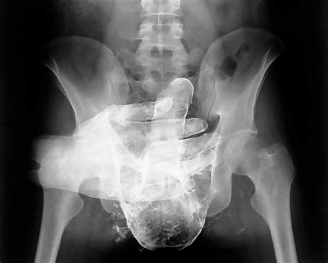 Sex Under Mri Or Xray Porn Pictures XXX Photos Sex Images 1529946