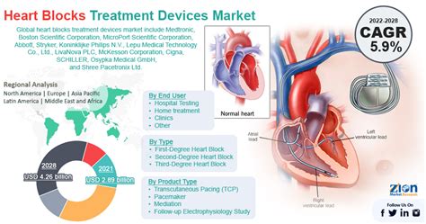 Global Heart Blocks Treatment Devices Market Revenue Estimated Around