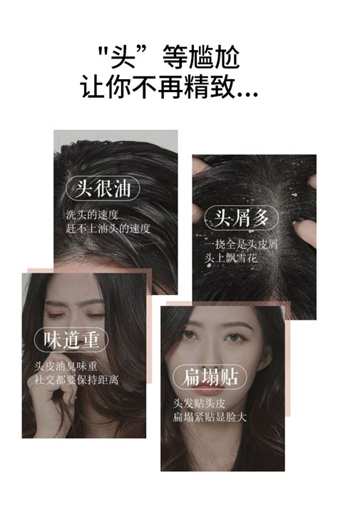 妍绮二硫化硒洗头水去屑洗发露清爽控油柔顺蓬松洗发剂抖音爆款 阿里巴巴