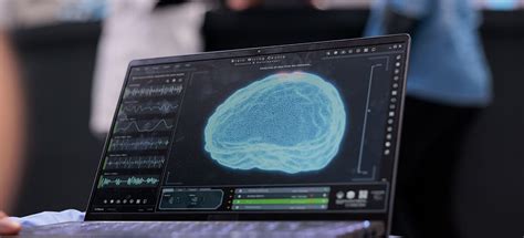 Superior Parkinsons Treatment With Deep Brain Simulations Kauvery