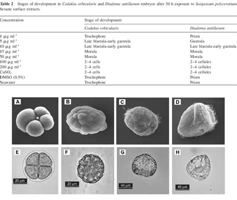 Ad Sem Images Magnifications500 Of Early Stage Of Codakia