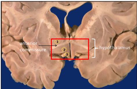 Intro To Neuroscience Hormones And Sex Flashcards Quizlet