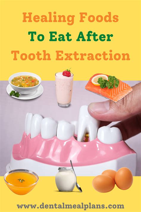Healing Foods To Eat After Tooth Extraction [and A Free Sample Meal