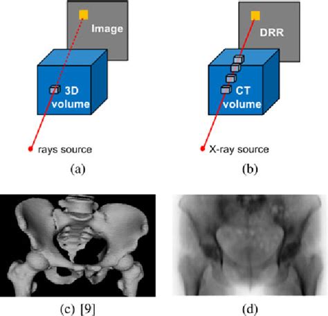 Figure 1 From Gpu Accelerated Generation Of Digitally Reconstructed Radiographs For 2 D3 D