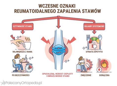 Reumatoidalne zapalenie stawów RZS przyczyny objawy leczenie