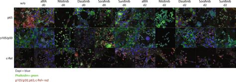 Dasatinib Nilotinib Sorafenib And Sunitinib Do Not Differentially