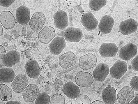 Exploring The Microscopic World A Guide To Different Microscope Types