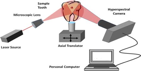 Custom Optical Imaging System For Early Caries Detection Using Download Scientific Diagram