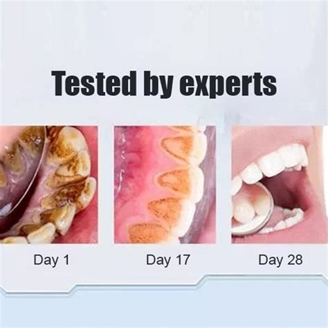 Super Probiotic 6 Toothpaste