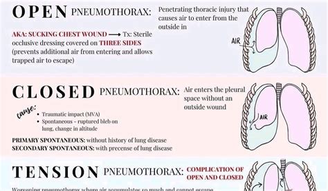 Types Of Pneumothorax