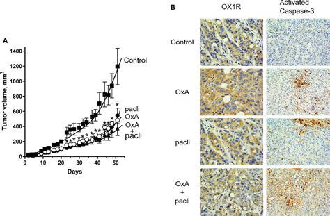 Figure 4 From The Orexin A Ox1r System Induces Cell Death In Pancreatic