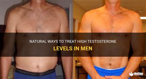 Natural Ways To Treat High Testosterone Levels In Men Medshun