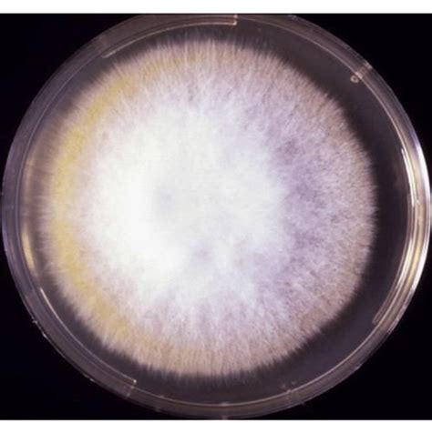 Lab 7 Introduction To Fungi And Culture Molds Flashcards Quizlet