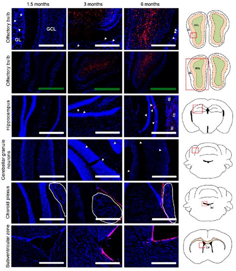 Nestin Cell Fate Mapping In The Central Nervous System Transgenic Download Scientific Diagram