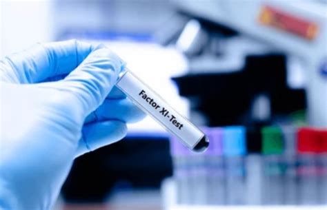 Overview Of Factor Xi Protein Creative Diagnostics