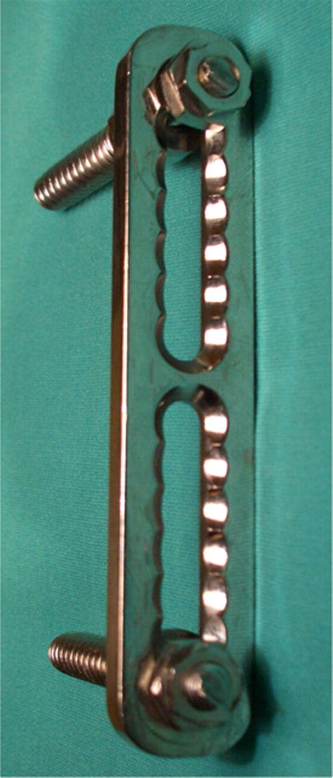 Lumbar Fusion Hardware At Eula Lofgren Blog