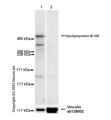 Anti Apolipoprotein B Antibody Epr27473 49 Ab312318 Abcam