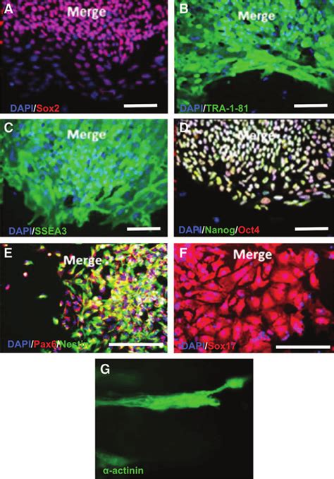Ipsc Colonies Derived From Fibroblasts Reprogrammed With Mrna Cocktail