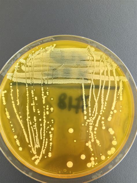 Contaminated Streak Plate
