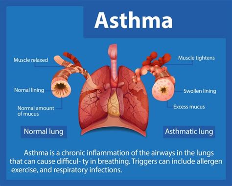 Lungs Infographic Images Free Download On Freepik