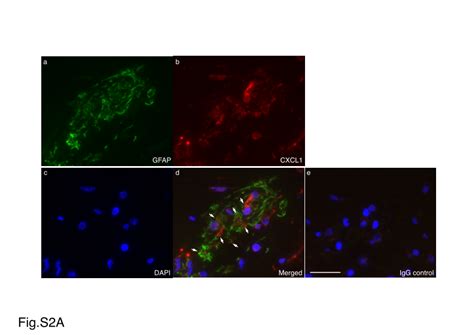 Pdf Unsaturated Aldehyde Acrolein Promotes Retinal Glial Cell Migration