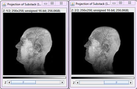 Z Functions Imagej