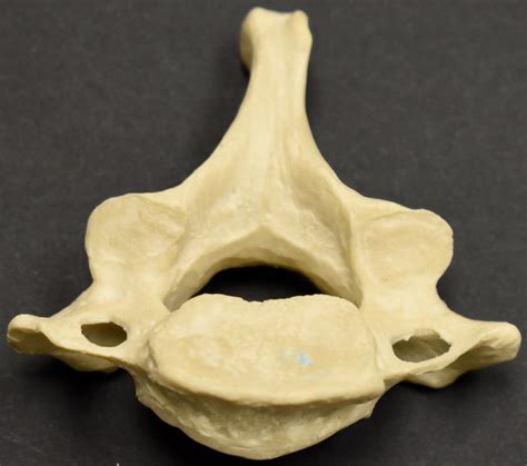 Cervical Vertebra Inferior View Diagram Quizlet