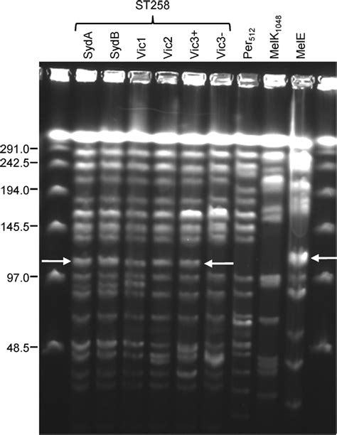 Pulsed Field Gel Electrophoresis Pfge Of Dna From Study Isolates