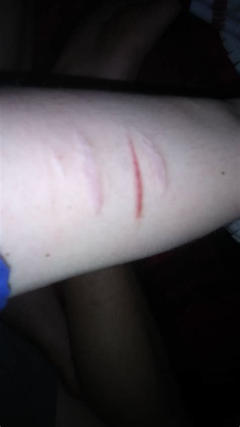 Old Sh Scars Rscars