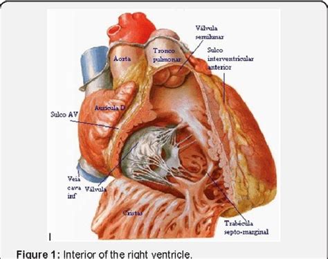 Supraventricular Crest
