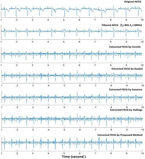 Sensors Free Full Text A Novel Technique For Fetal Ecg Extraction